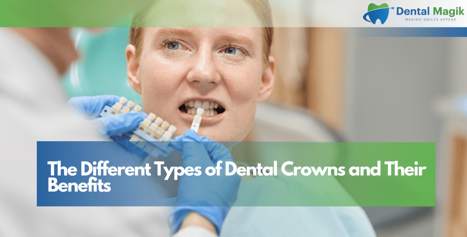 The Different Types of Dental Crowns and Their Benefits | Dental Magik