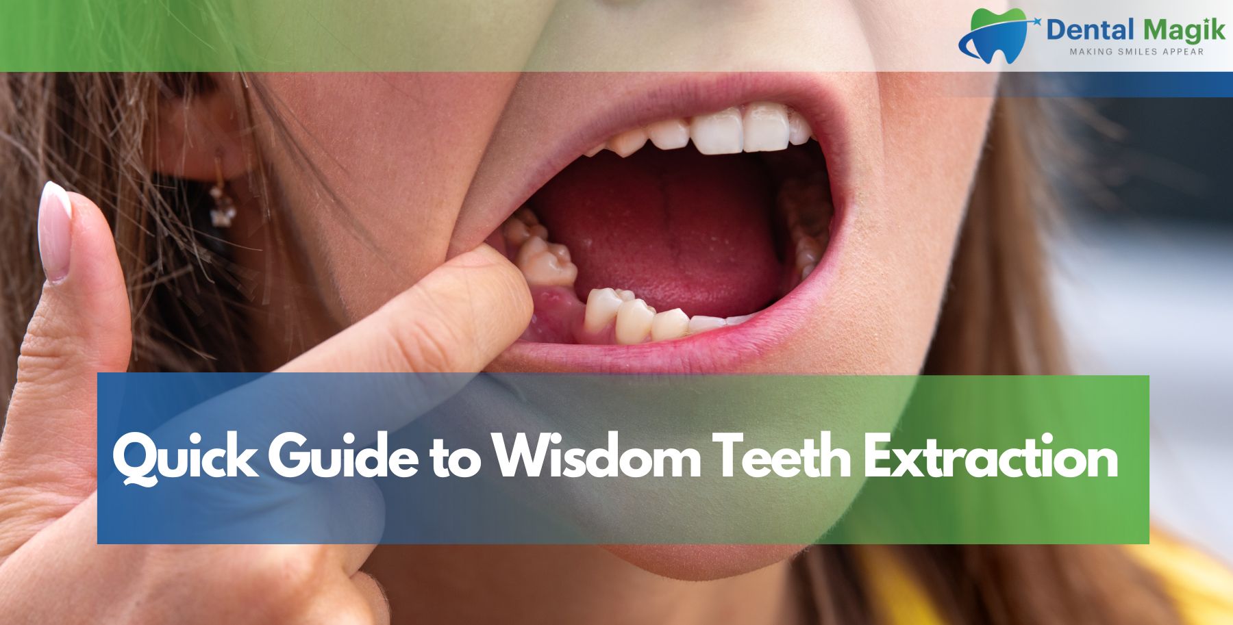 Quick Guide to Wisdom Teeth Extraction | Dental Magik
